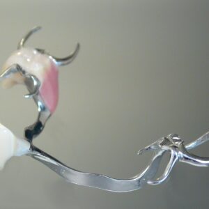 Frame prothesen – Goedegebuure Tandtechniek