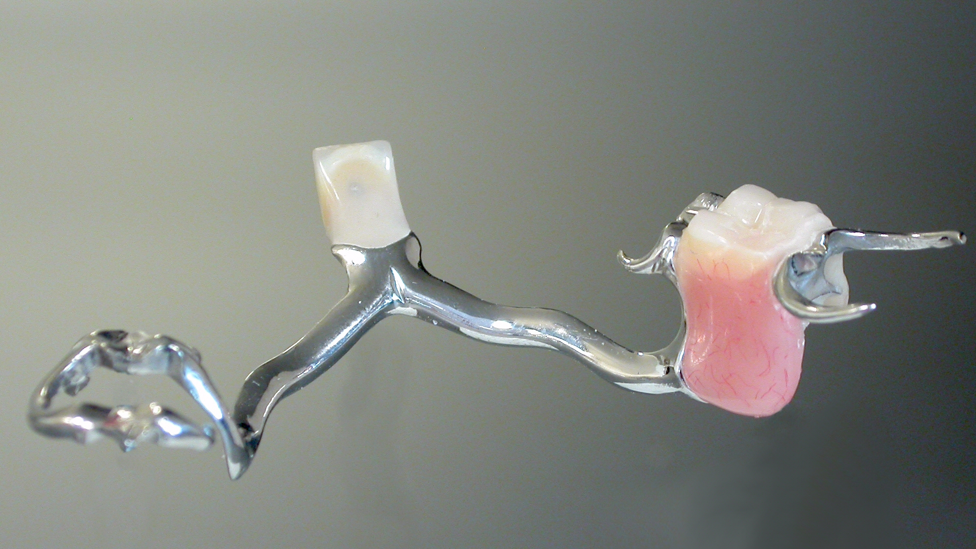 Frame prothesen – Goedegebuure Tandtechniek