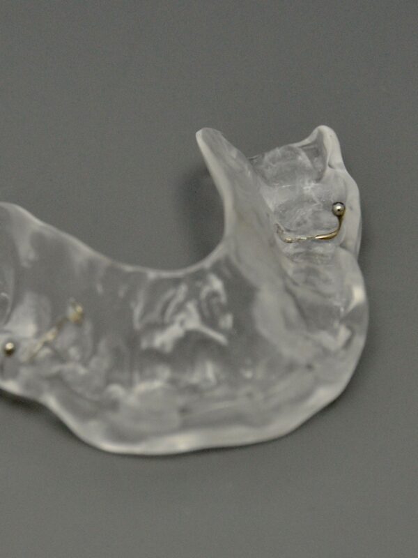 Opbeetplaten en splints – Goedegebuure Tandtechniek