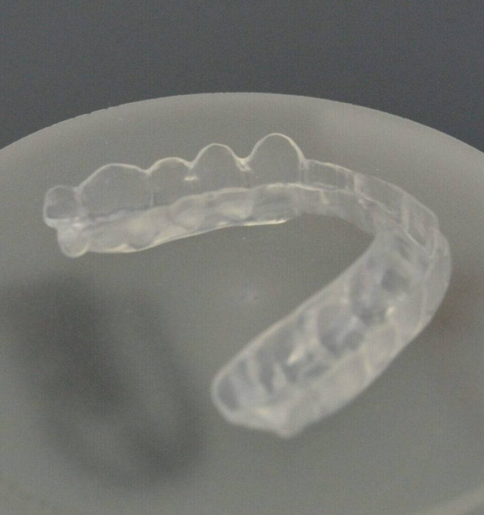 Opbeetplaten en splints – Goedegebuure Tandtechniek